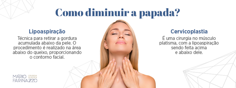 Como diminuir a papada: qual é o melhor procedimento?