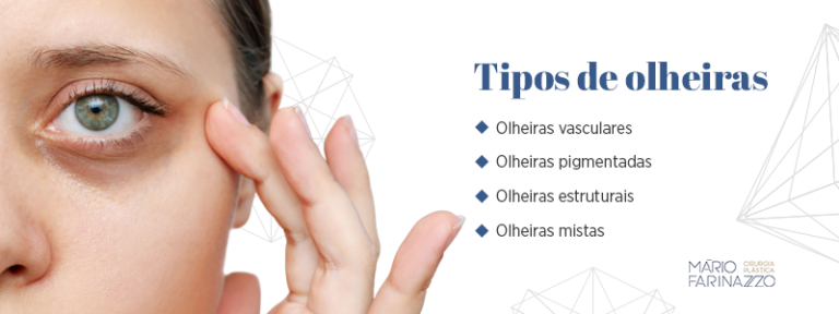 Preenchimento de olheiras: para que serve e como é feito?