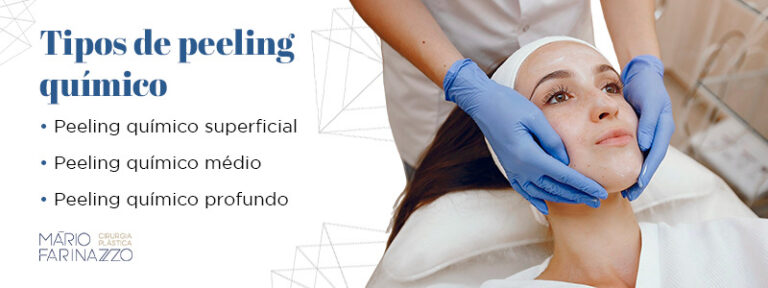 Peeling químico: saiba tudo sobre o procedimento estético