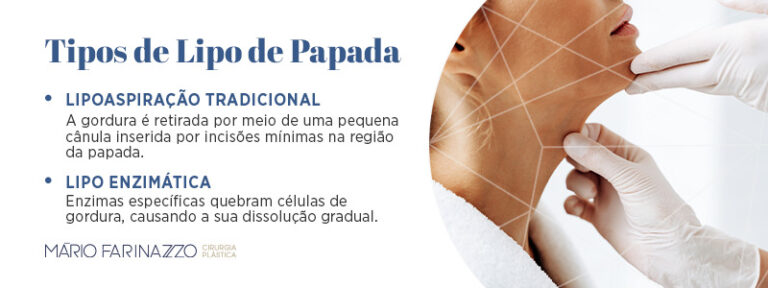 Lipo de papada: o que é, como é feita e quando fazer